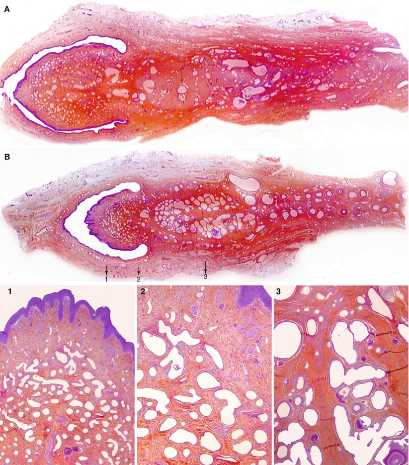 Structure of the Bulbo-clitoral Organ | SpringerLink