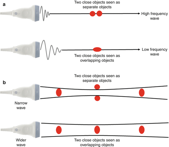 Basics of Ultrasound Imaging | SpringerLink