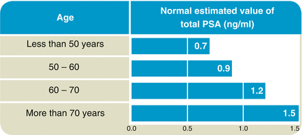 Prostate-Specific Antigen (PSA) | SpringerLink