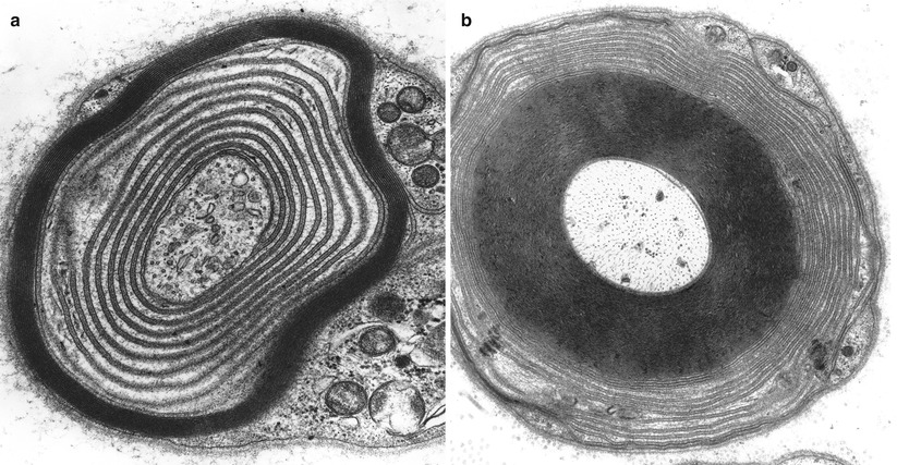 Schwann Cells and Myelin in the Peripheral Nervous System | SpringerLink