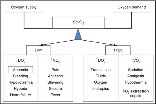 ScvO2 as an Alternative Transfusion Trigger | SpringerLink