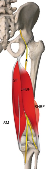 Hamstrings | SpringerLink