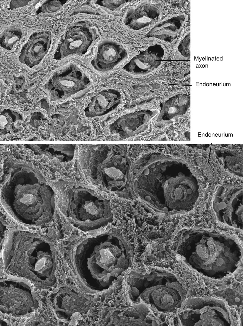 Ultrastructure of Myelinated and Unmyelinated Axons | SpringerLink