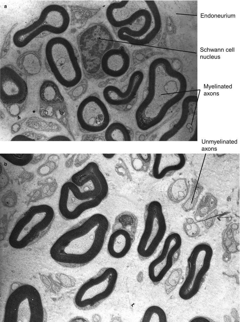 Ultrastructure of Myelinated and Unmyelinated Axons | SpringerLink