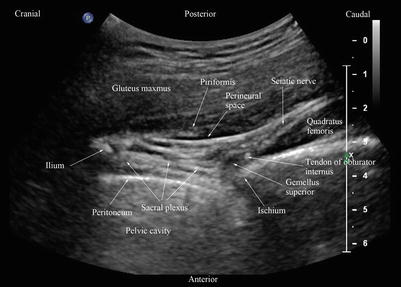 High-Definition and Three-Dimensional Volumetric Ultrasound Imaging of ...