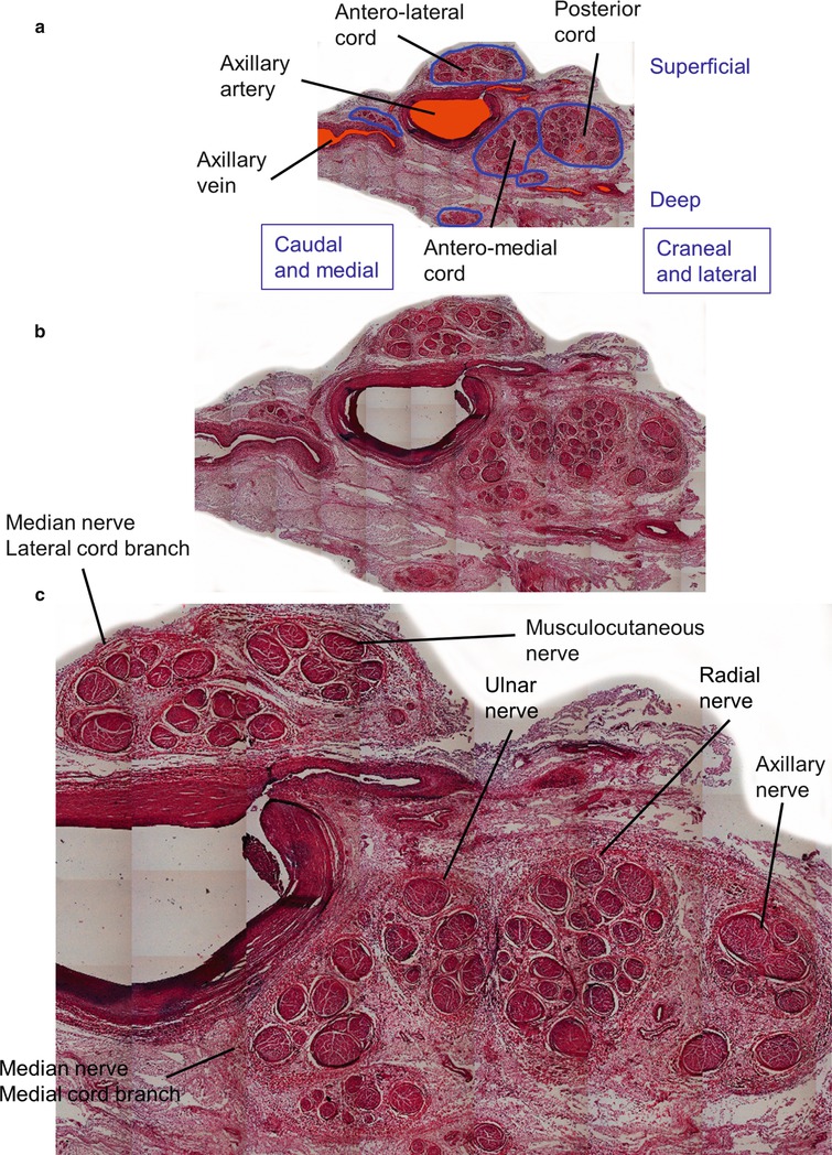 Cross-Sectional Microscopic Anatomy of the Brachial Plexus and ...