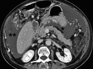Abdominal Cavity, Peritoneum and Retroperitoneum | SpringerLink