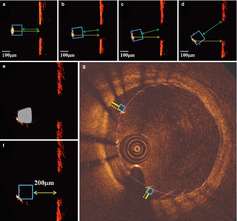 Intravascular OCT Imaging Artifacts | SpringerLink