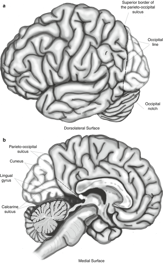 Occipital Lobe Resections | SpringerLink