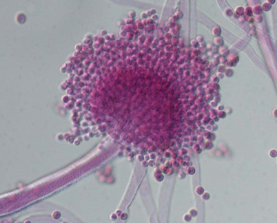 Basic Mycology | SpringerLink