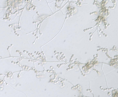 Basic Mycology | SpringerLink