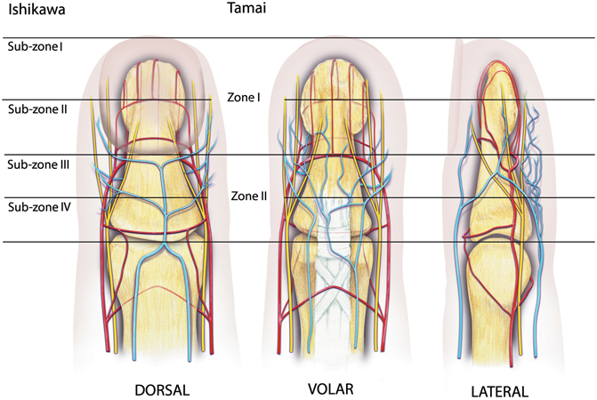 Fingertip Amputations: Supermicrosurgery and Replantation | SpringerLink