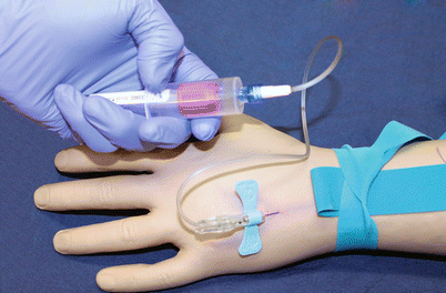 Venipuncture | SpringerLink