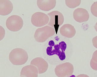 Ehrlichiosis | SpringerLink