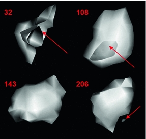 Generation of Patient-Specific 3D Cardiac Chamber Models for Real-Time ...