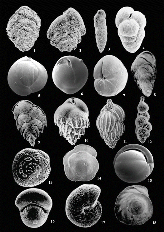 Calcareous-Walled Microfossils | SpringerLink