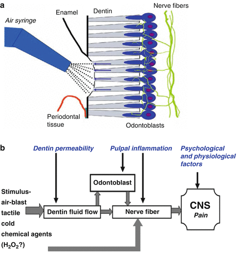 The Physiological Basis of Dentin Hypersensitivity | SpringerLink