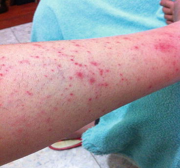 Clinical Picture in Adulthood and Unusual and Peculiar Clinical ...