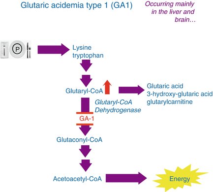 Nutrition Management of Glutaric Acidemia Type 1 | SpringerLink