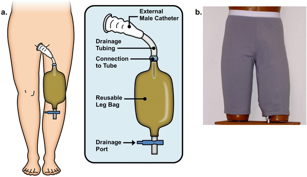 Urinary Drainage Bags | SpringerLink