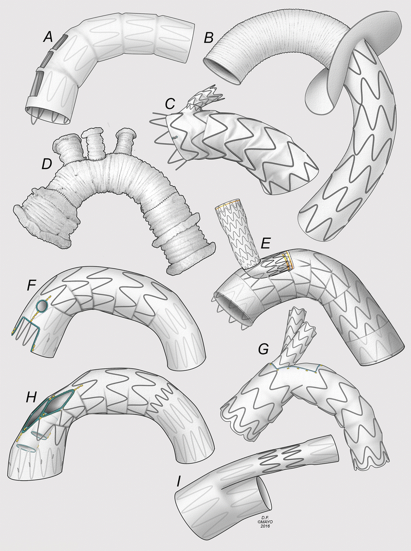 Managing Endovascular Inventory | SpringerLink