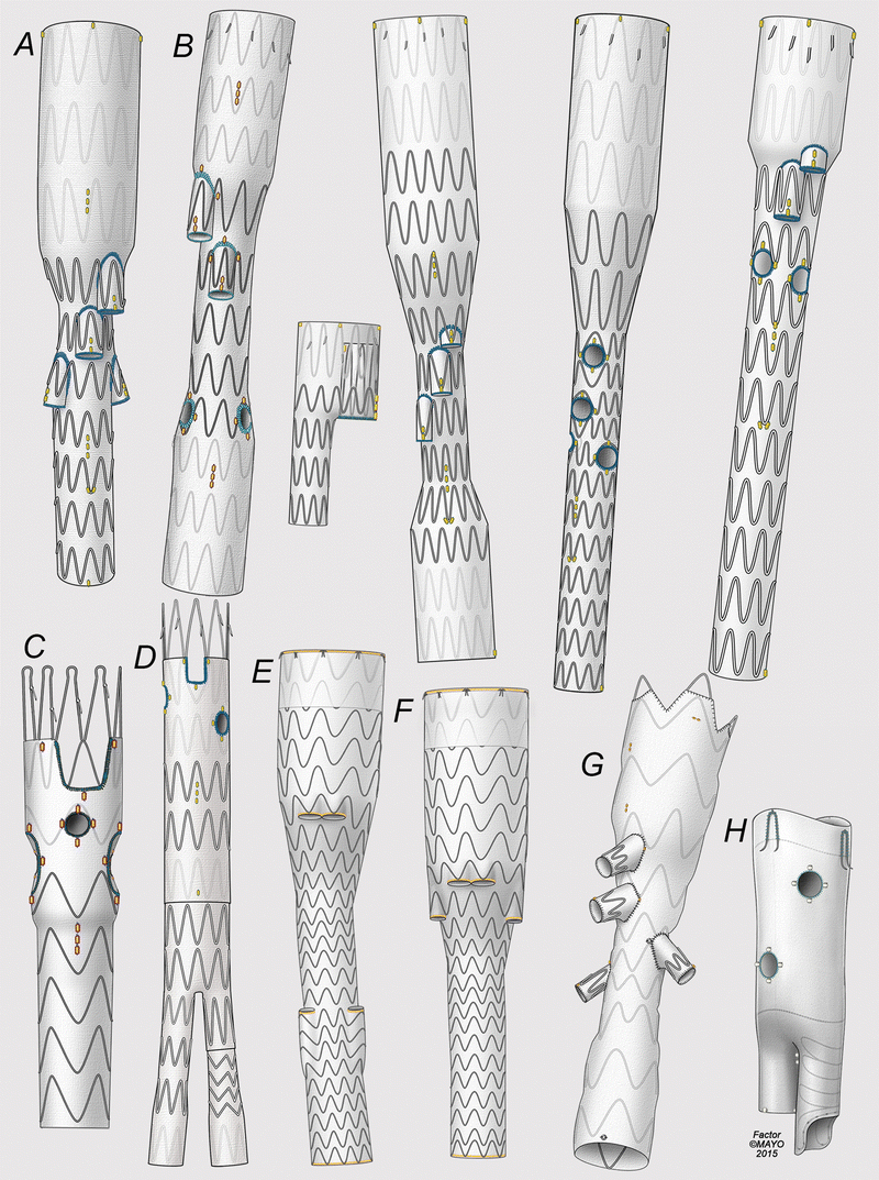 Managing Endovascular Inventory | SpringerLink
