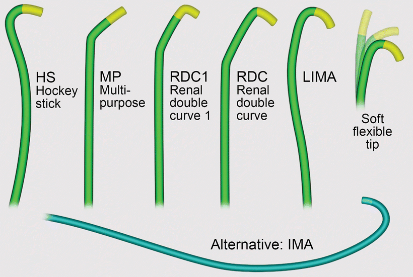 Managing Endovascular Inventory | SpringerLink