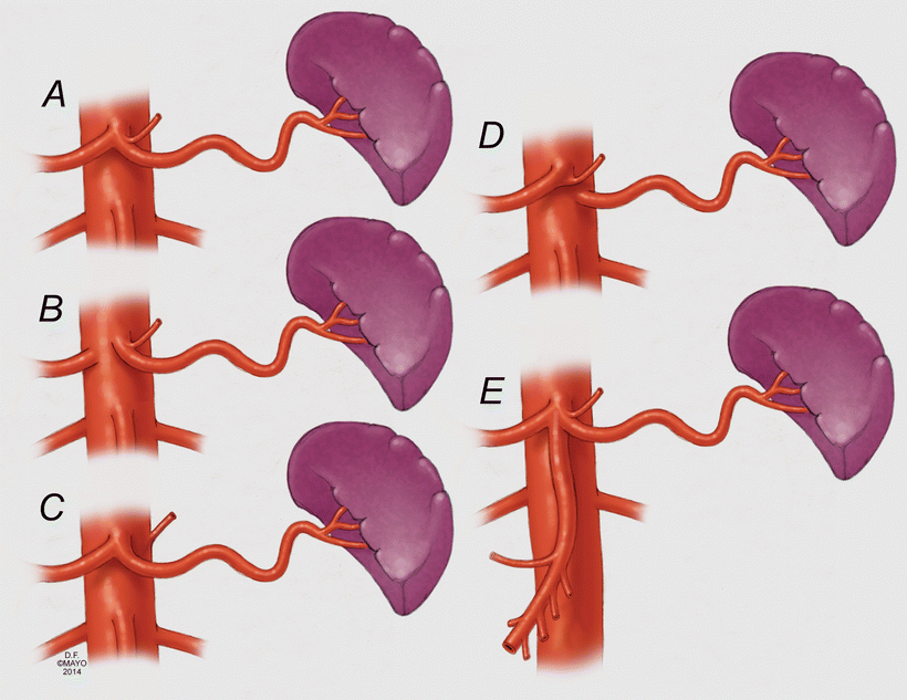 Normal Aortic Anatomy and Variations of Its Branches | SpringerLink