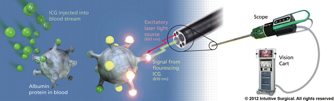 Robotic Surgery Using Firefly System | SpringerLink