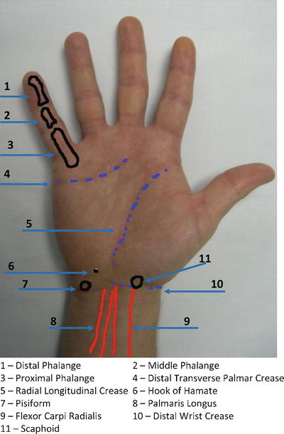 The Hand and Wrist | SpringerLink