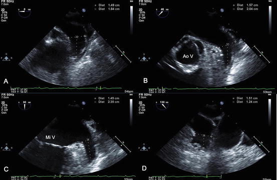 WATCHMAN Device | SpringerLink