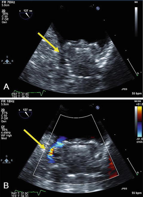WATCHMAN Device | SpringerLink