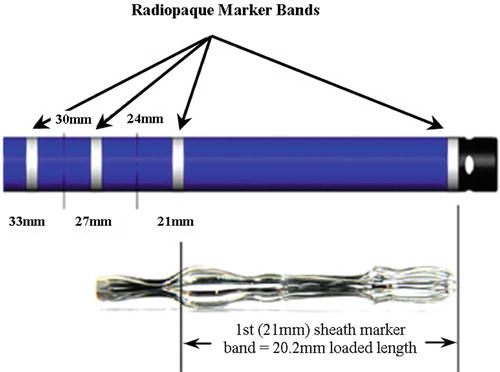 WATCHMAN Device | SpringerLink