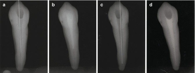 Manual Dynamic Activation (MDA) Technique | SpringerLink