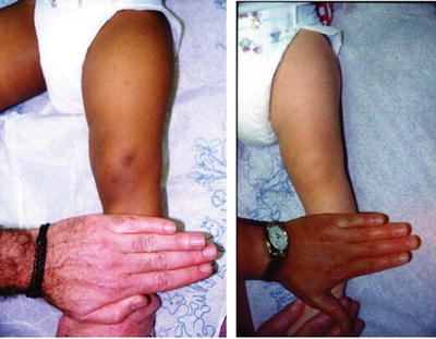 Clinical Evaluation Including Imaging | SpringerLink