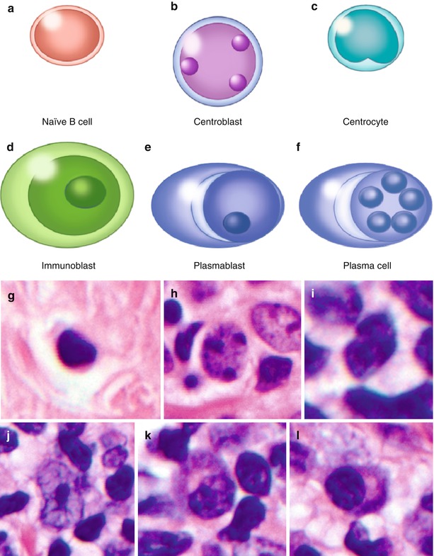 Introduction to the B-Cell Lymphomas | SpringerLink