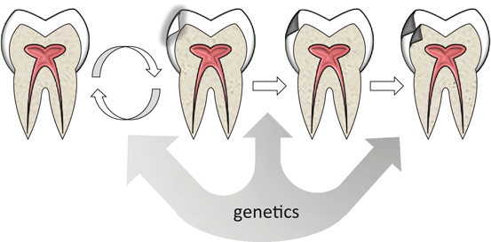 Caries | SpringerLink