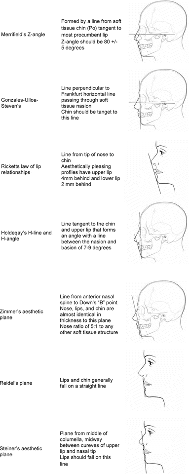 Genioplasty | SpringerLink