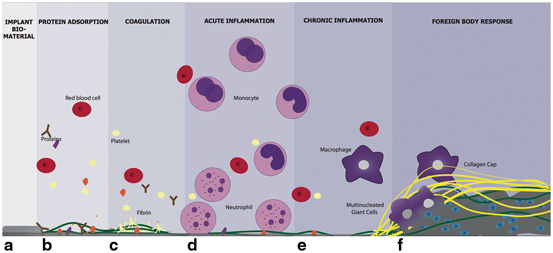 The Role of Macrophages in the Foreign Body Response to Implanted ...