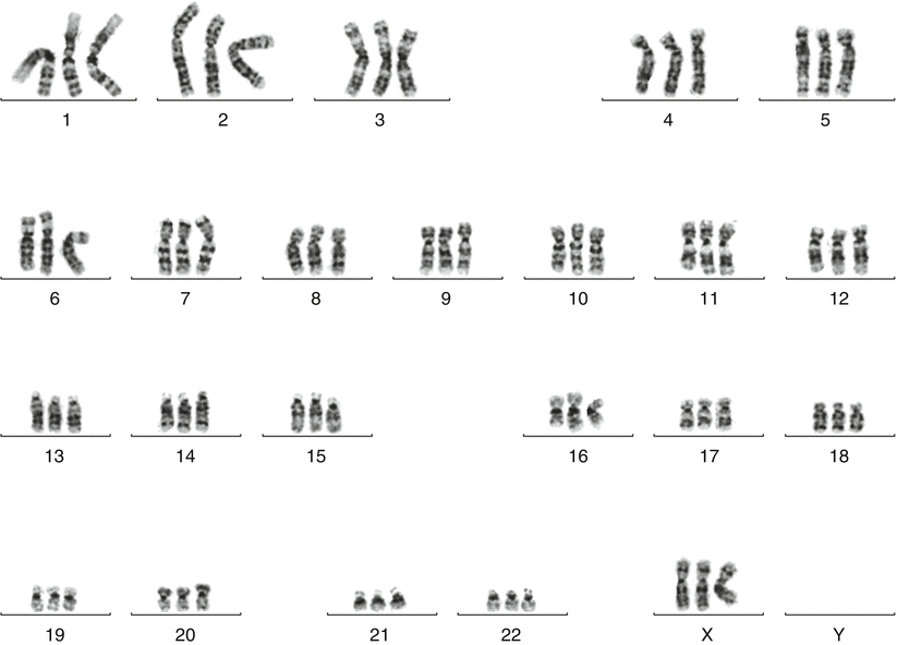 Genetic and Epigenetic Basis of Development and Disease | SpringerLink