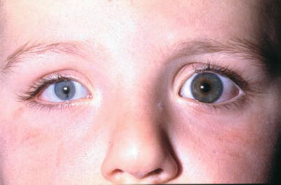 The Special Senses | SpringerLink