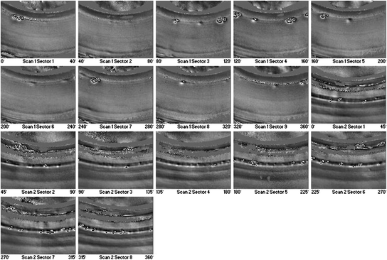 On Shearography Testing of Tires Separations | SpringerLink