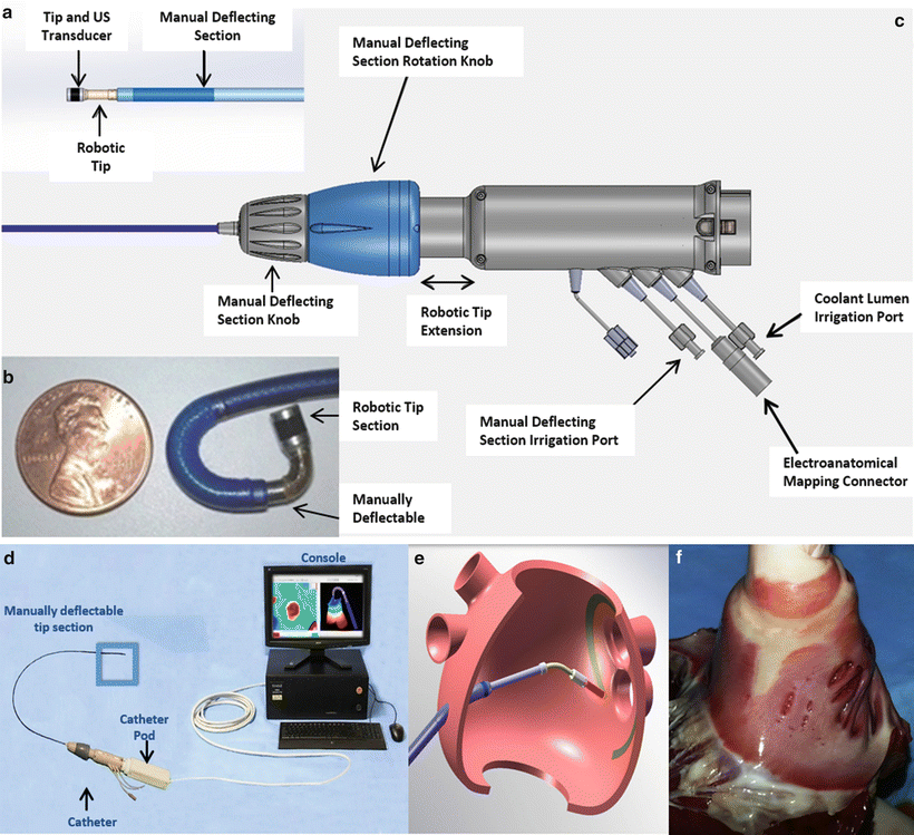Cardiac Ablative Technologies | SpringerLink