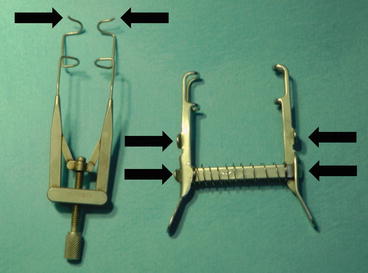 The Speculum and Its Placement | SpringerLink