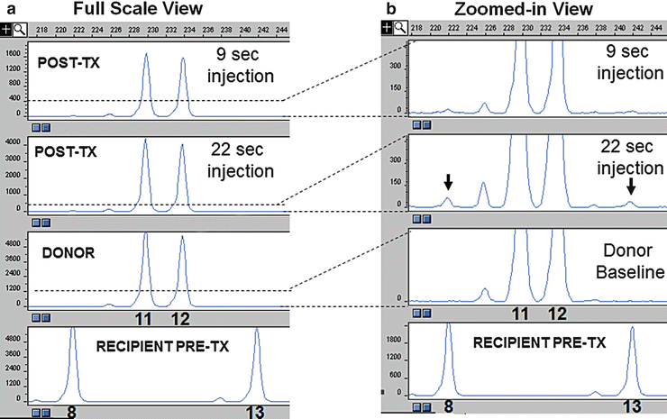 Chimerism Testing in Allogeneic Hematopoietic Stem Cell Transplantation ...