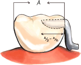 Rests and Rest Seats | SpringerLink