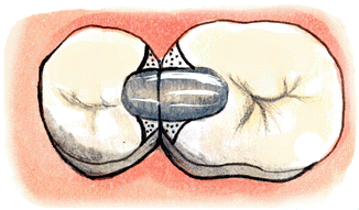 Rests and Rest Seats | SpringerLink