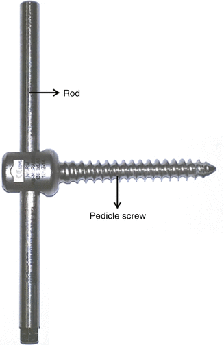 Mechanical Testing Standards of Orthopedic Implants | SpringerLink