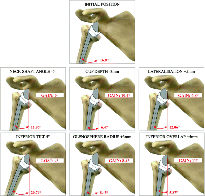 Depuy Synthes DELTA XTEND™ | SpringerLink