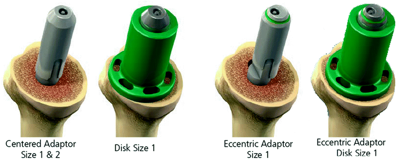 Depuy Synthes DELTA XTEND™ | SpringerLink